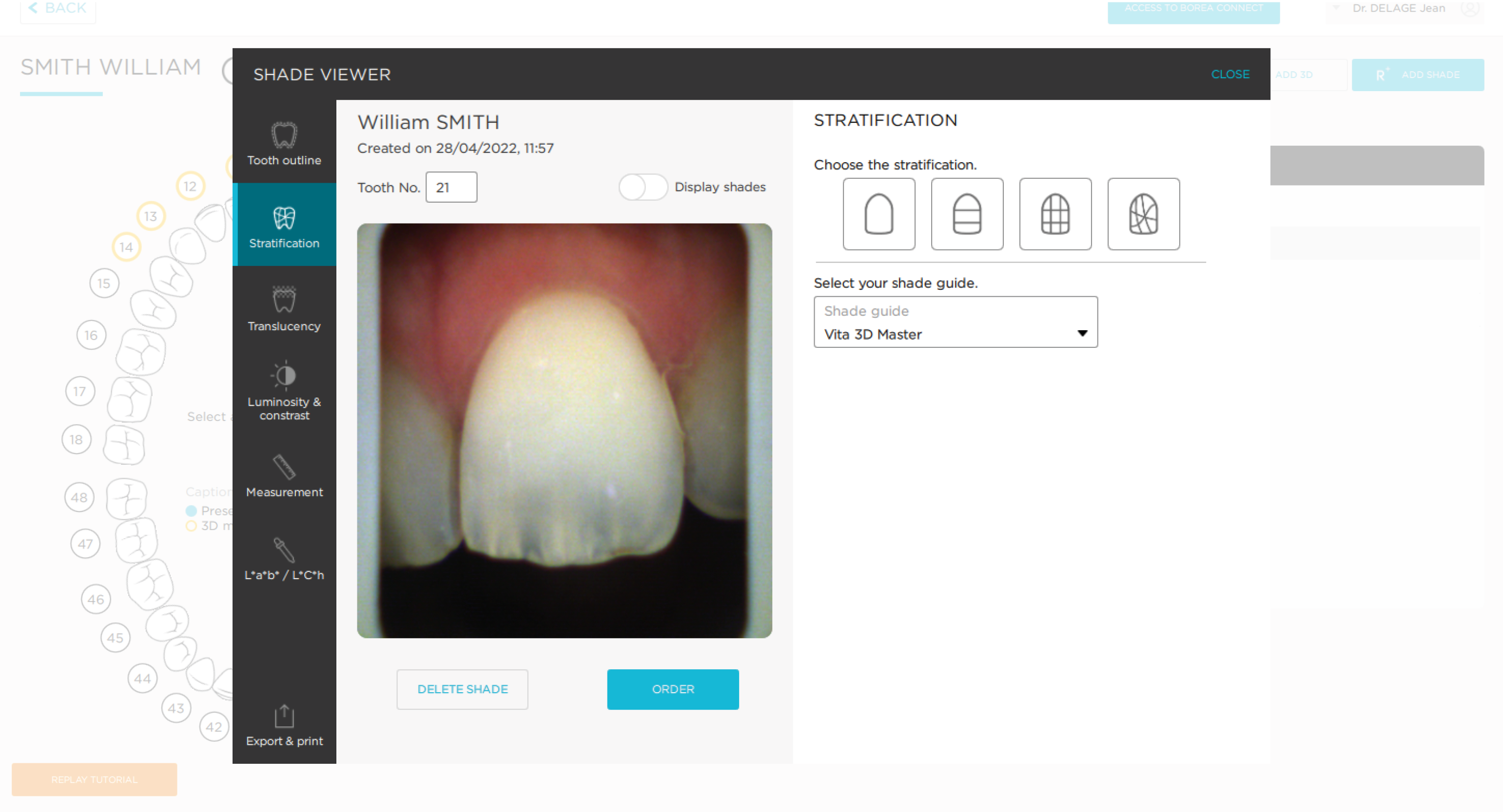 Vision software - Borea Dental