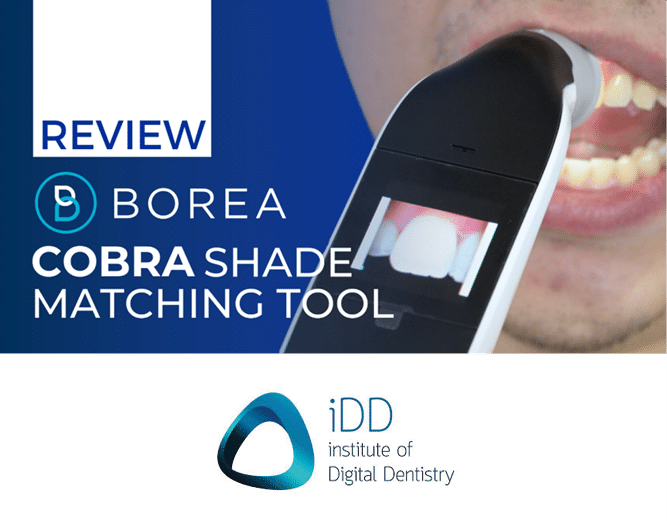 Cobra Shade Scan review - Borea Dental